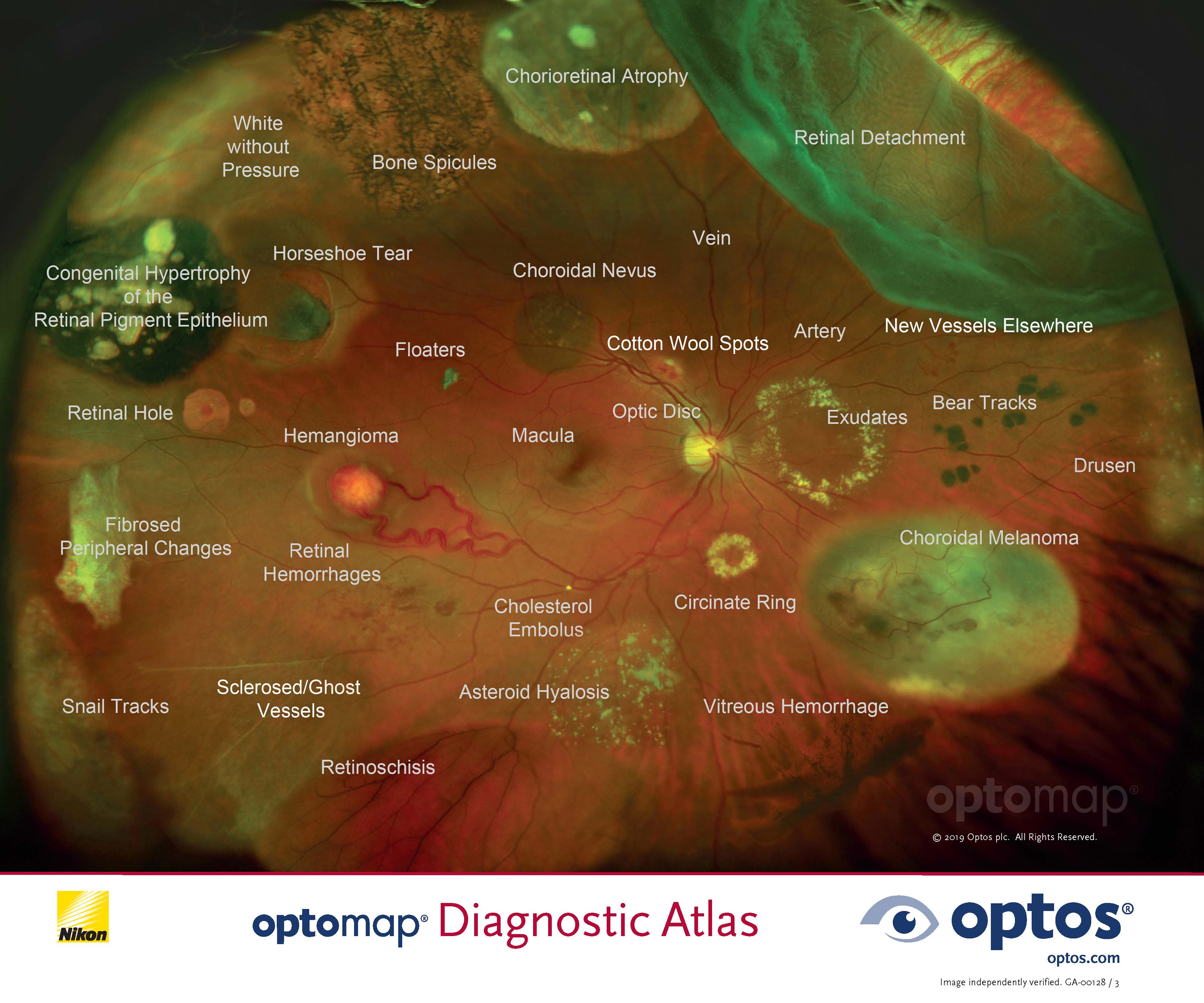 Diagnostic and Educational Tools for optomap | Access Materials